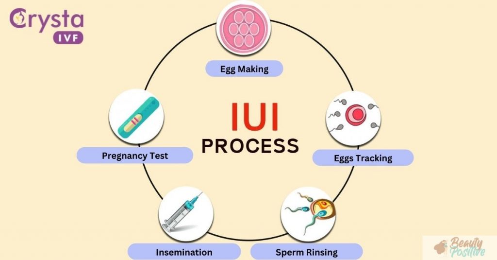 Symptoms of Pregnancy After IUI Treatment - BeautyPositive.org